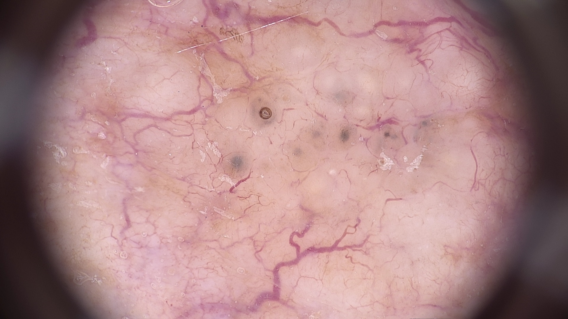 Basaliom – Bosch & Bosch